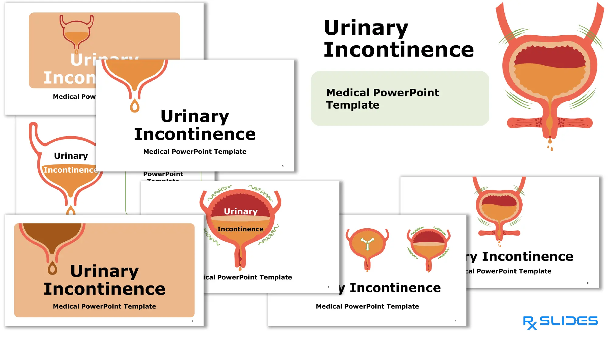 Download Urinary Incontinence PowerPoint Template| RxSlides